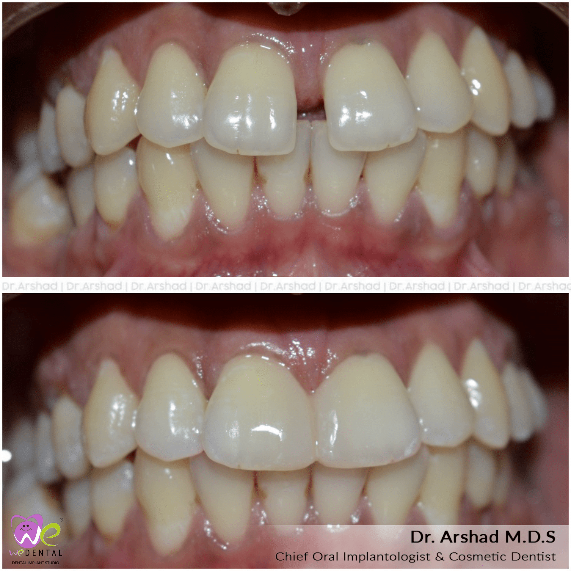 Dental services | Before & After