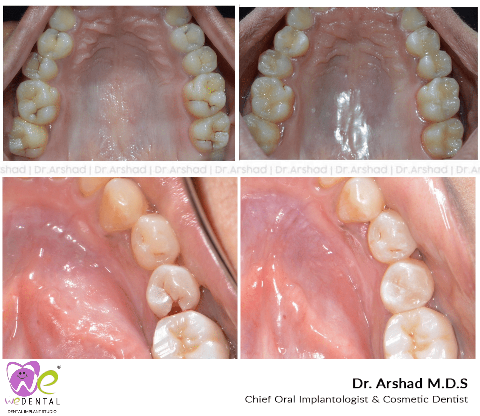 Dental services | Before & After